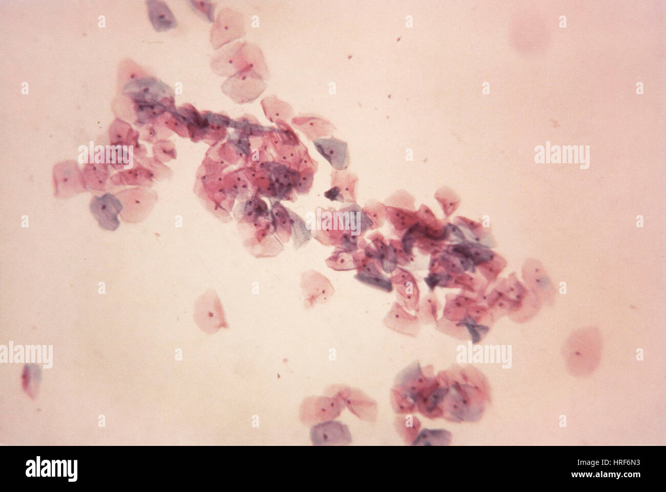 Pap test gebärmutterhalskrebs -Fotos und -Bildmaterial in hoher ...