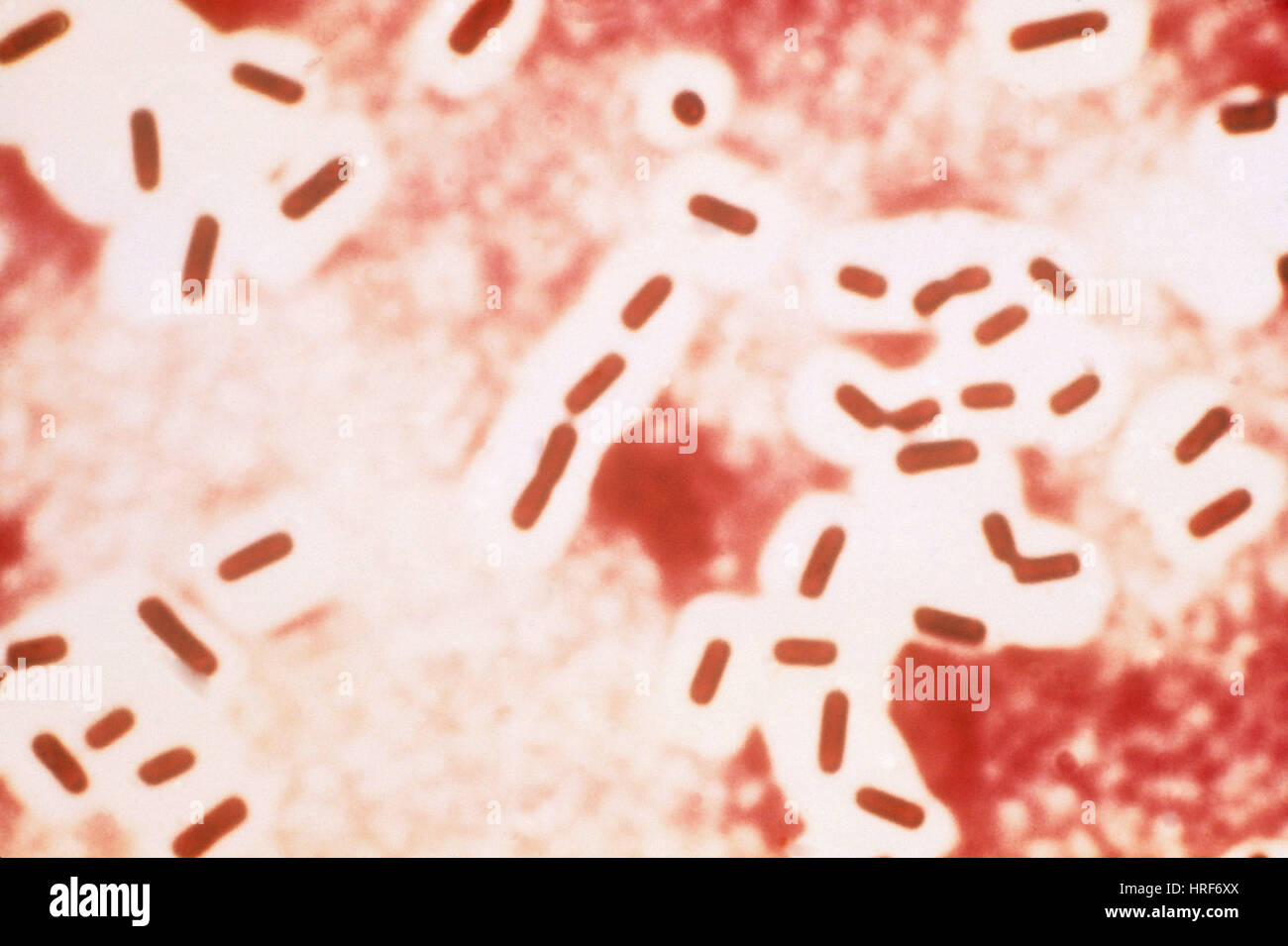 Clostridium perfringens bakterien -Fotos und -Bildmaterial in hoher ...