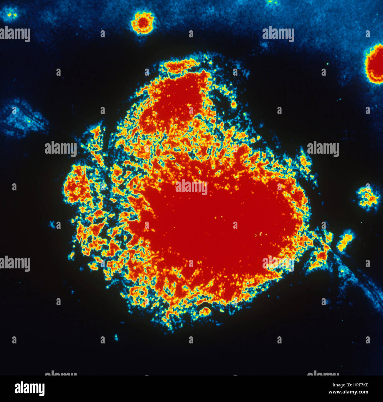 Rubeola masern -Fotos und -Bildmaterial in hoher Auflösung – Alamy