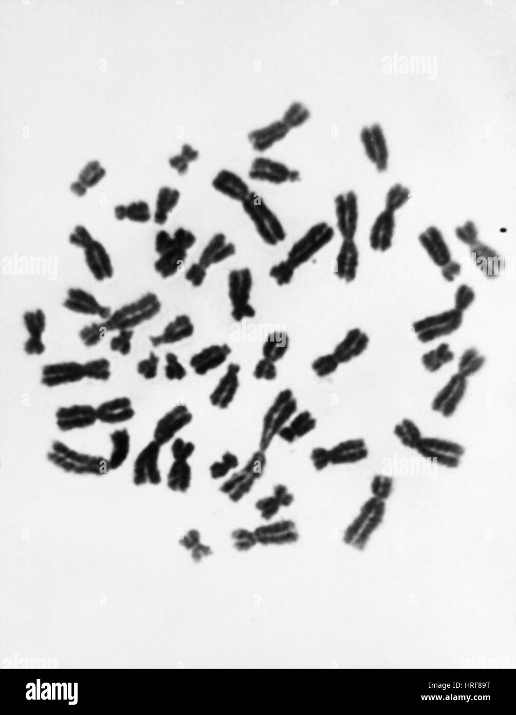 Karyotype female normal -Fotos und -Bildmaterial in hoher Auflösung – Alamy