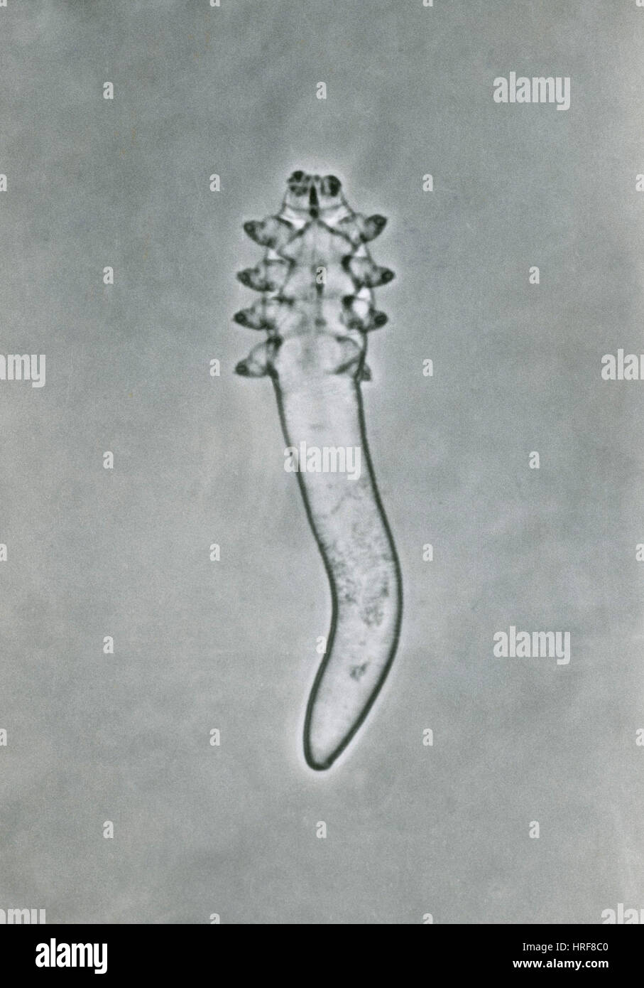 Milbe (Demodex Folliculorum Stockfotografie - Alamy