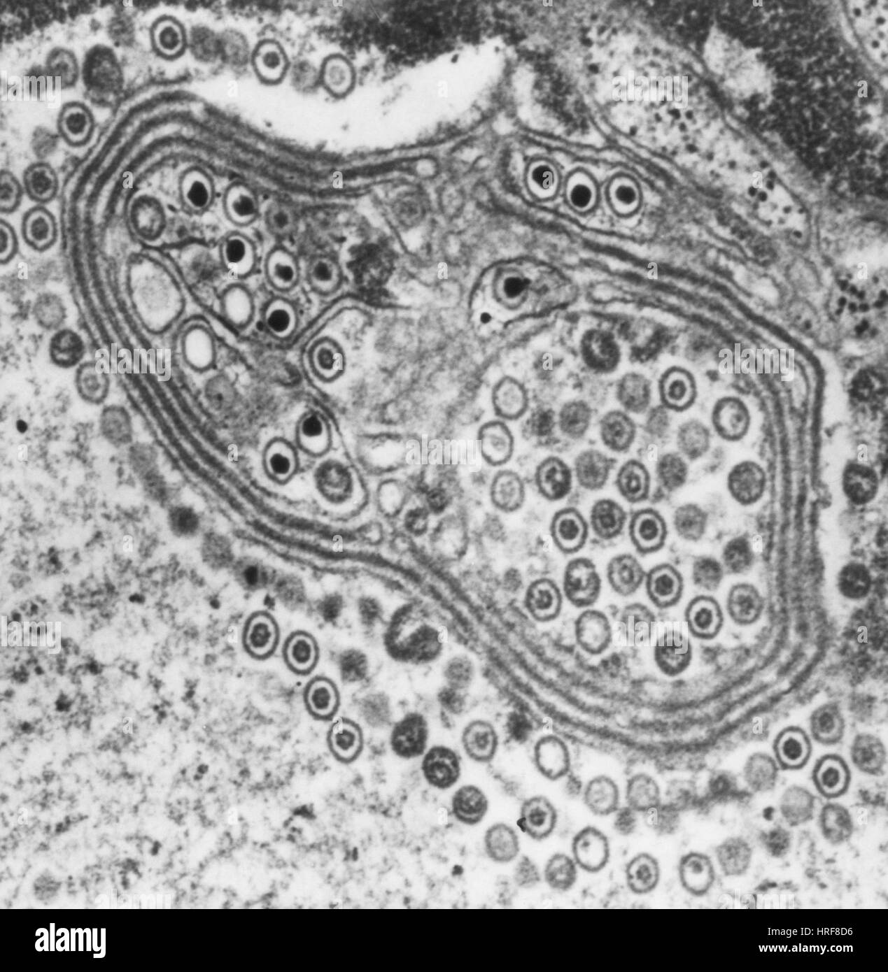 Tem membrane -Fotos und -Bildmaterial in hoher Auflösung – Alamy