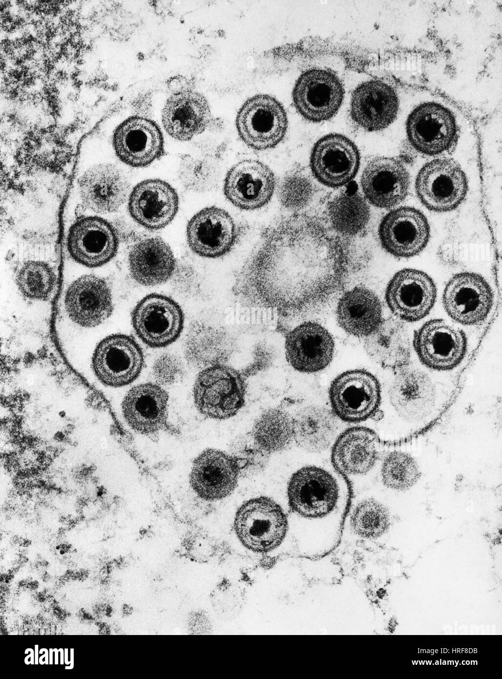 Herpes simplex virus 1 Schwarzweiß-Stockfotos und -bilder - Alamy