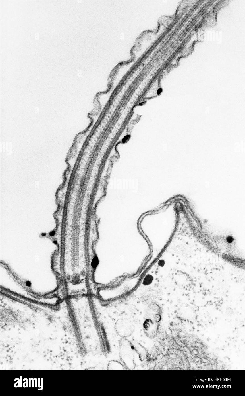 Motile cell -Fotos und -Bildmaterial in hoher Auflösung – Alamy