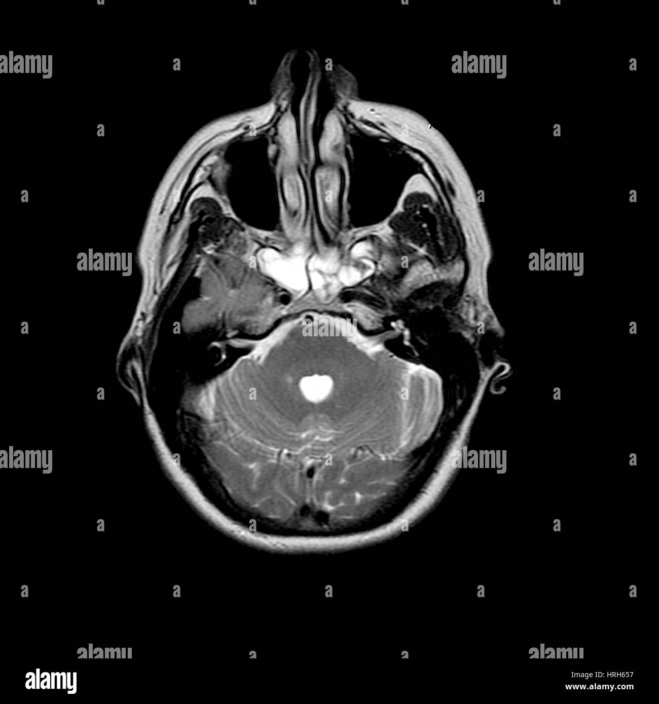 Sinus ct scan -Fotos und -Bildmaterial in hoher Auflösung – Alamy