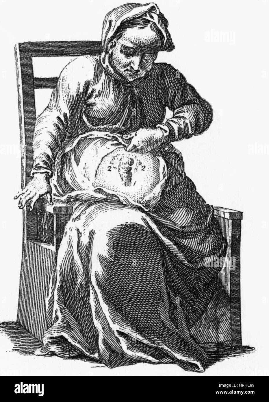 Female intestinal anatomy Schwarzweiß-Stockfotos und -bilder - Alamy