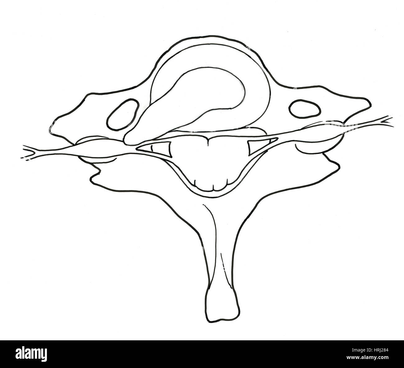 Bandscheibenvorfall illustration Ausgeschnittene Stockfotos und -bilder ...