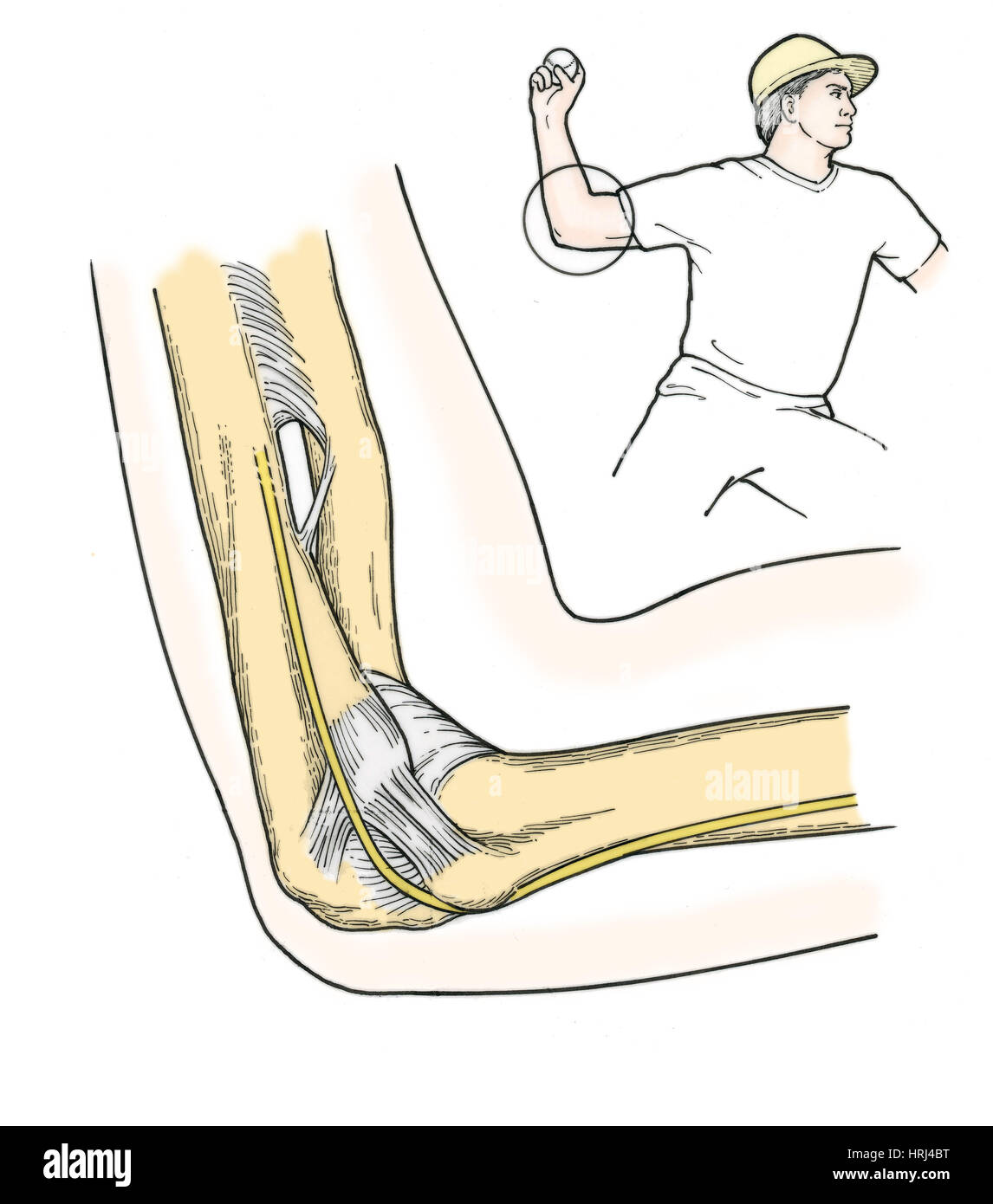 Illustration elbow ligaments -Fotos und -Bildmaterial in hoher ...