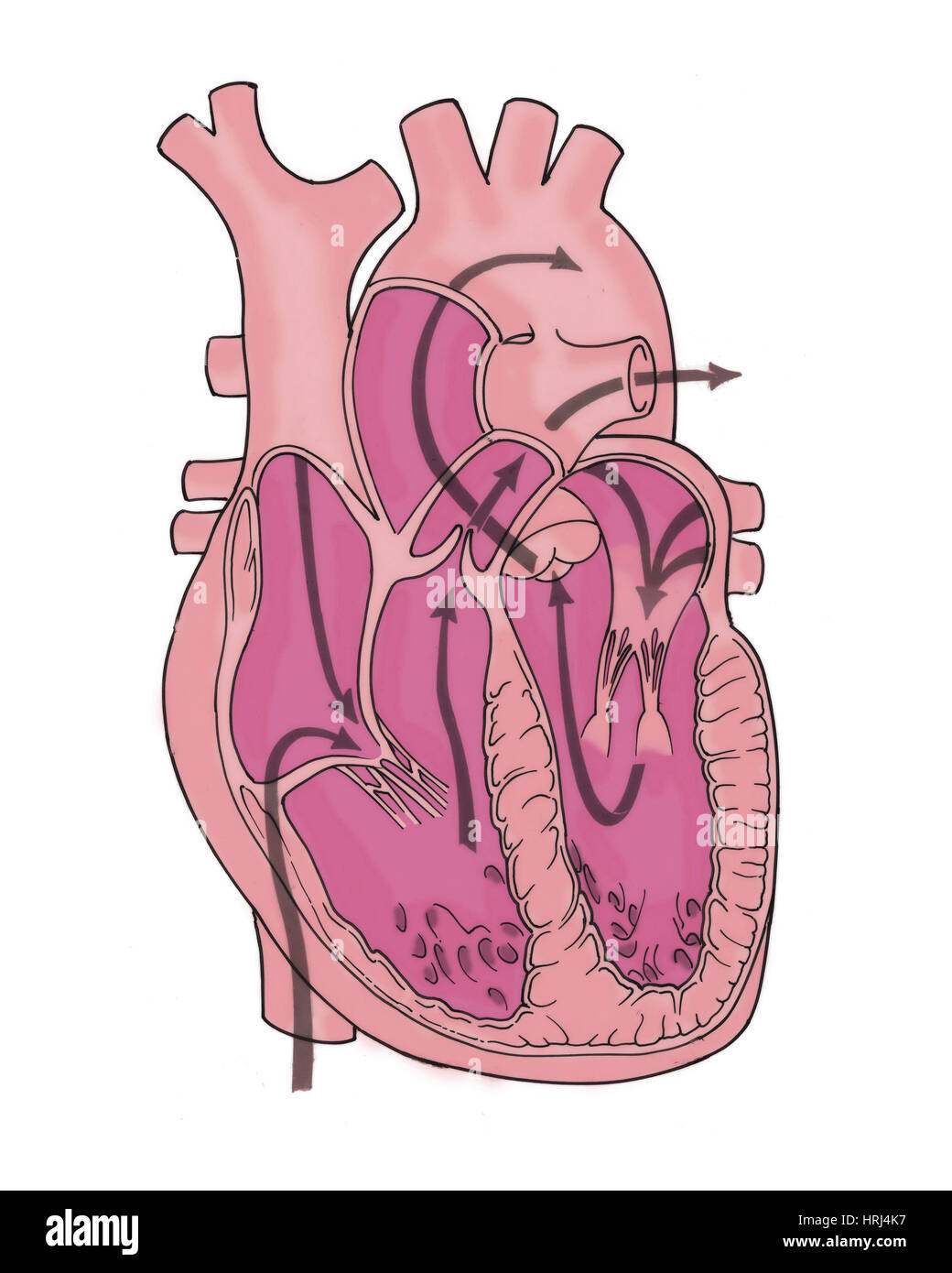 Coronary drawing -Fotos und -Bildmaterial in hoher Auflösung – Alamy