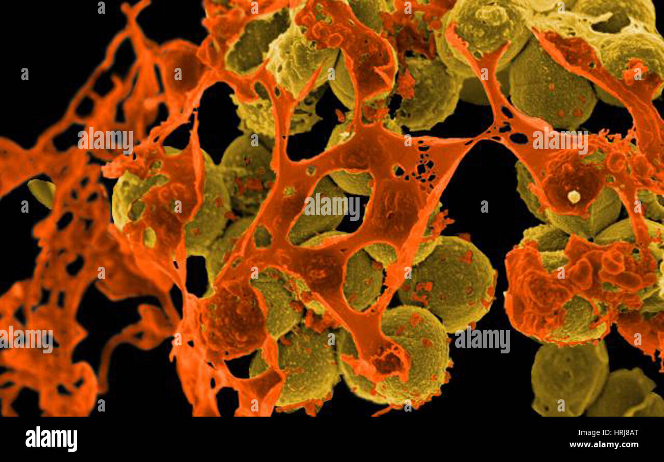 Staphylococcus Aureus Bakterien, MRSA, SEM Stockfotografie - Alamy