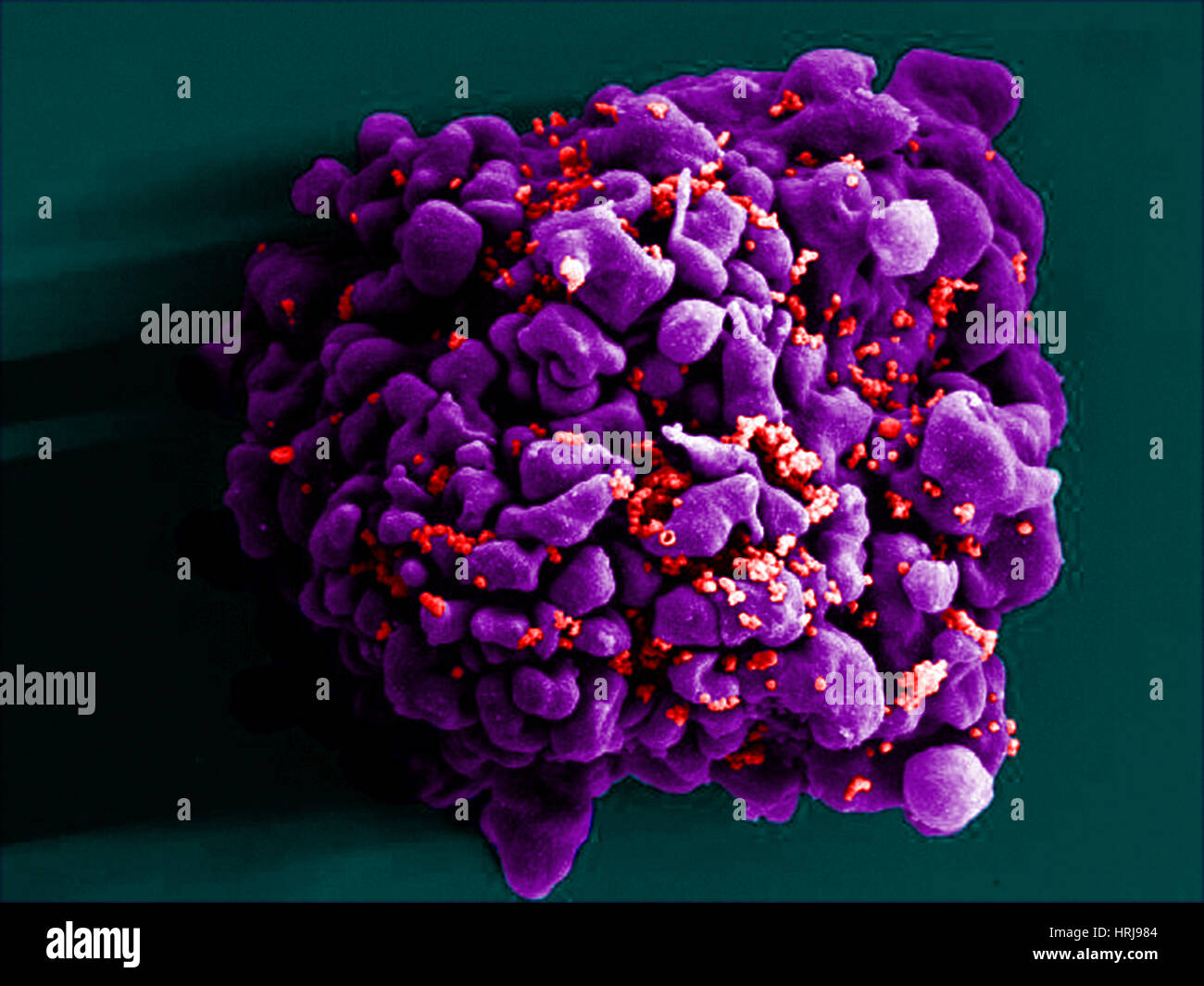 Hiv infizierte t zelle -Fotos und -Bildmaterial in hoher Auflösung – Alamy