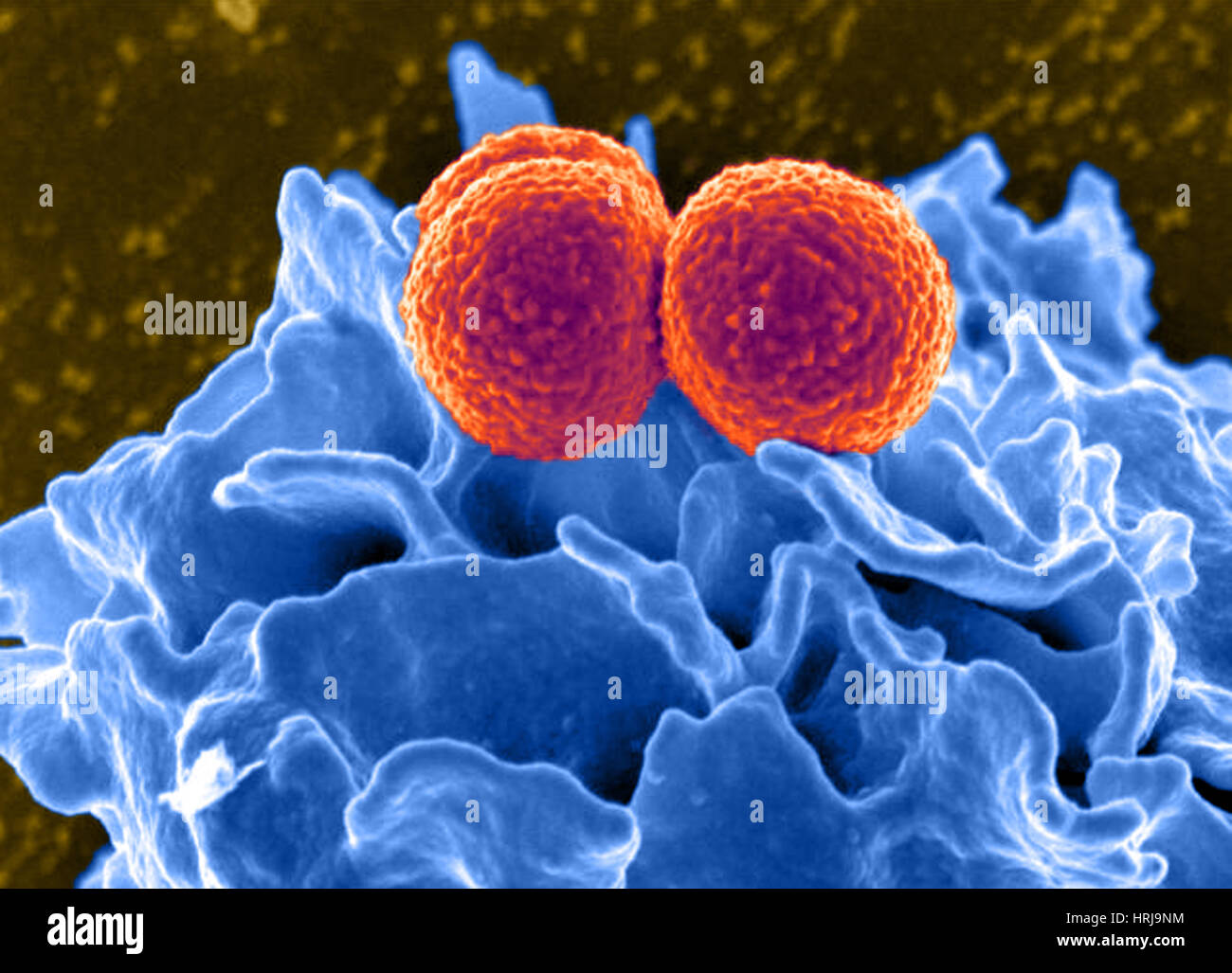Staphylococcus Aureus Bakterien, MRSA, SEM Stockfotografie - Alamy