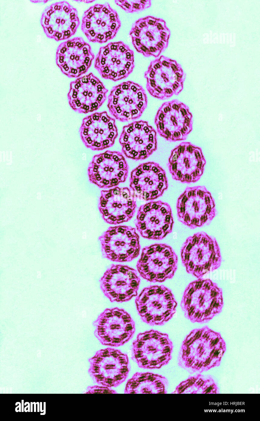 Die ciliaten -Fotos und -Bildmaterial in hoher Auflösung – Alamy