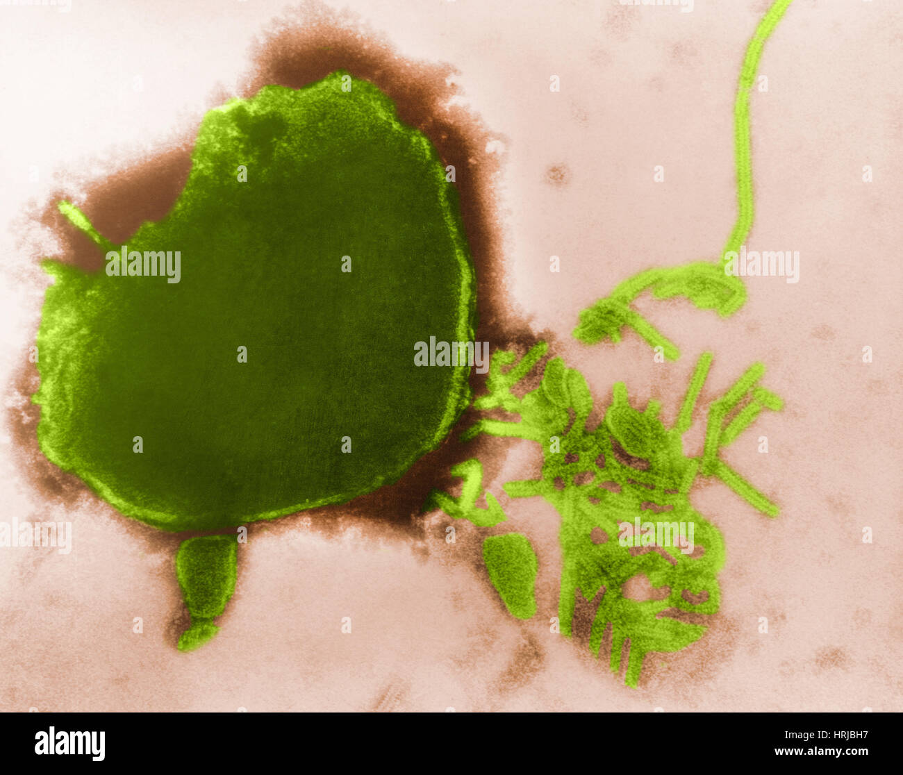 Mumps virus tem -Fotos und -Bildmaterial in hoher Auflösung – Alamy