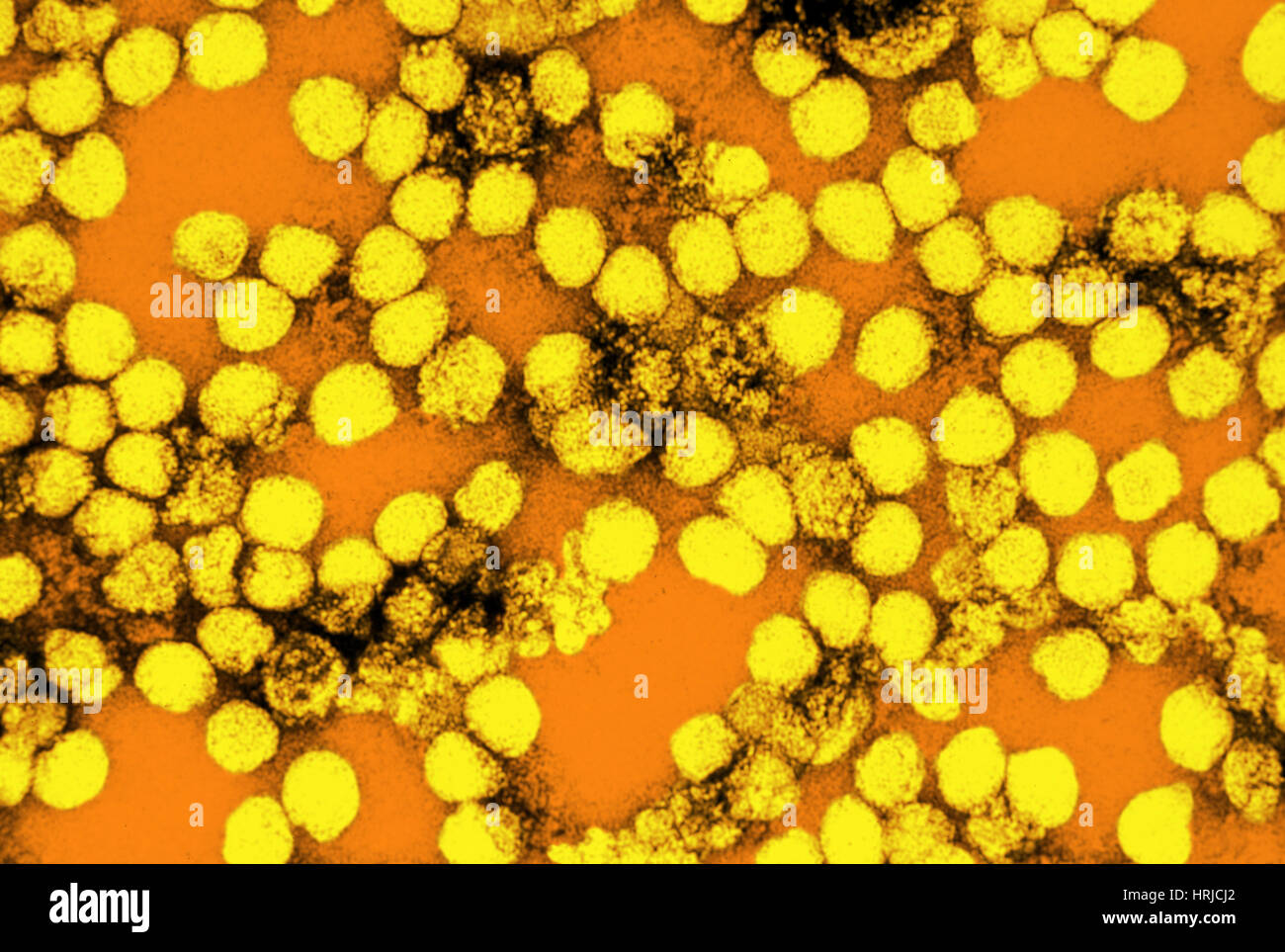 Gelbfieber-Virus, TEM Stockfoto, Bild: 135014714 - Alamy