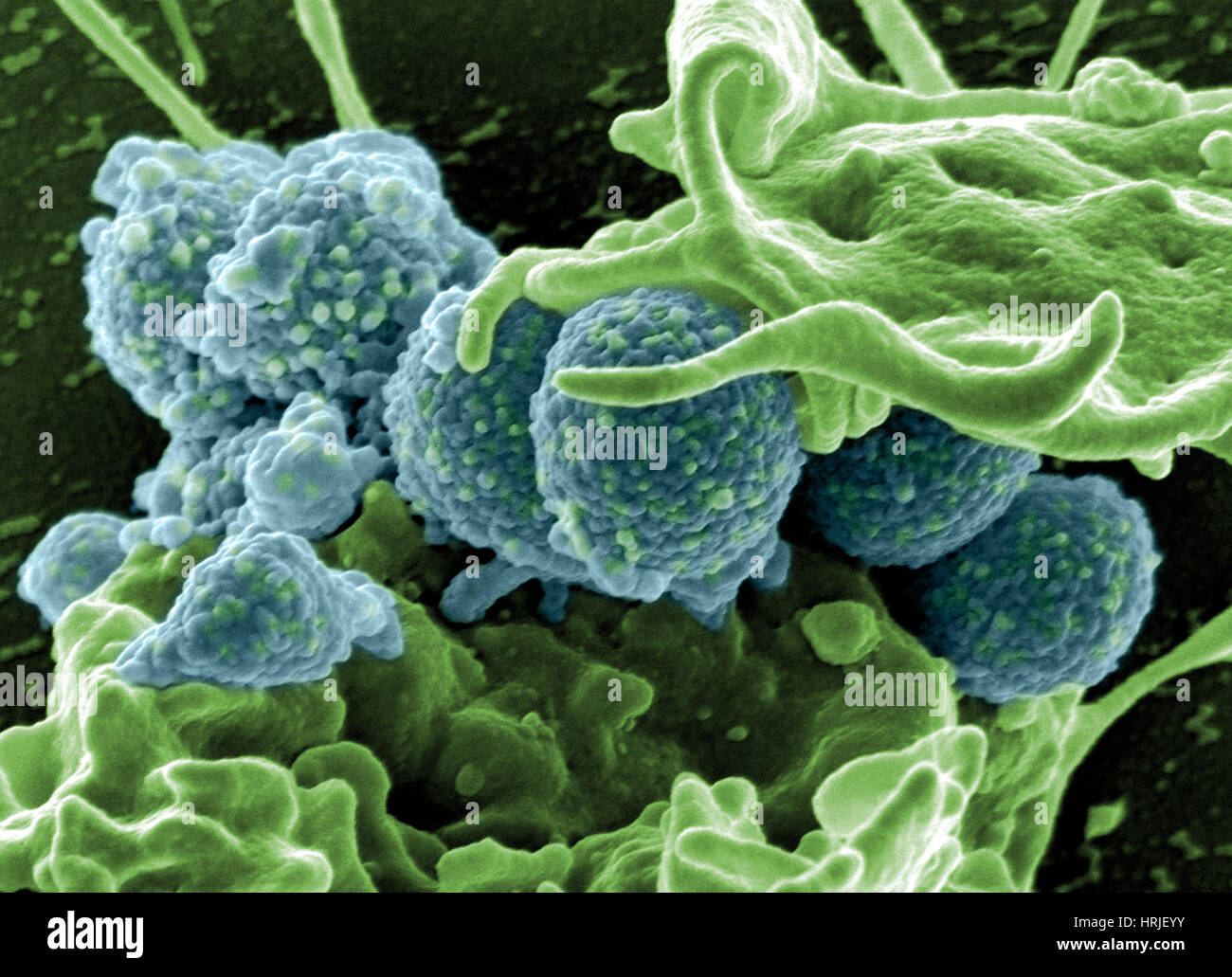 Staphylococcus aureus mrsa sem -Fotos und -Bildmaterial in hoher ...