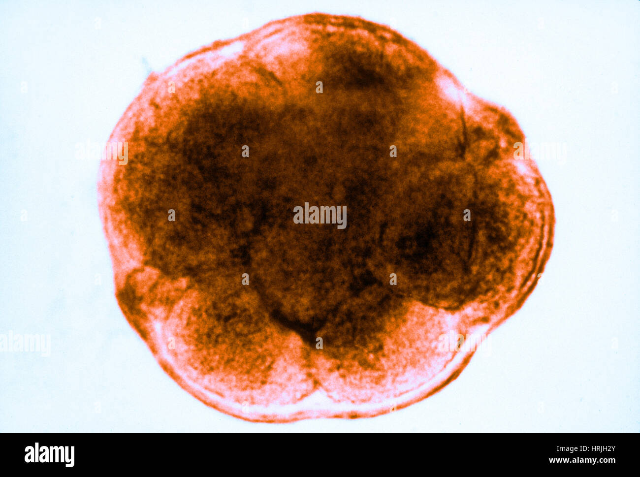 Ovum Human Stockfotos & Ovum Human Bilder - Alamy