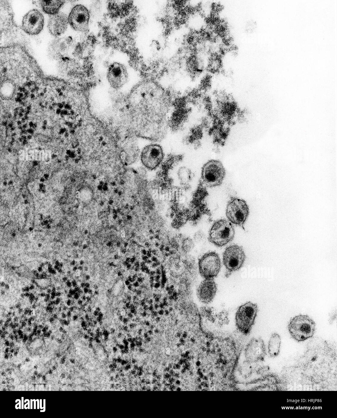 Hiv particles tem -Fotos und -Bildmaterial in hoher Auflösung – Alamy