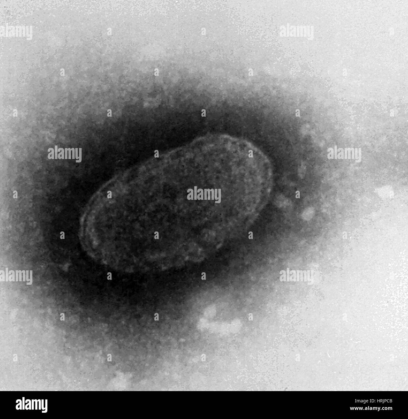 Viral exanthem -Fotos und -Bildmaterial in hoher Auflösung – Alamy