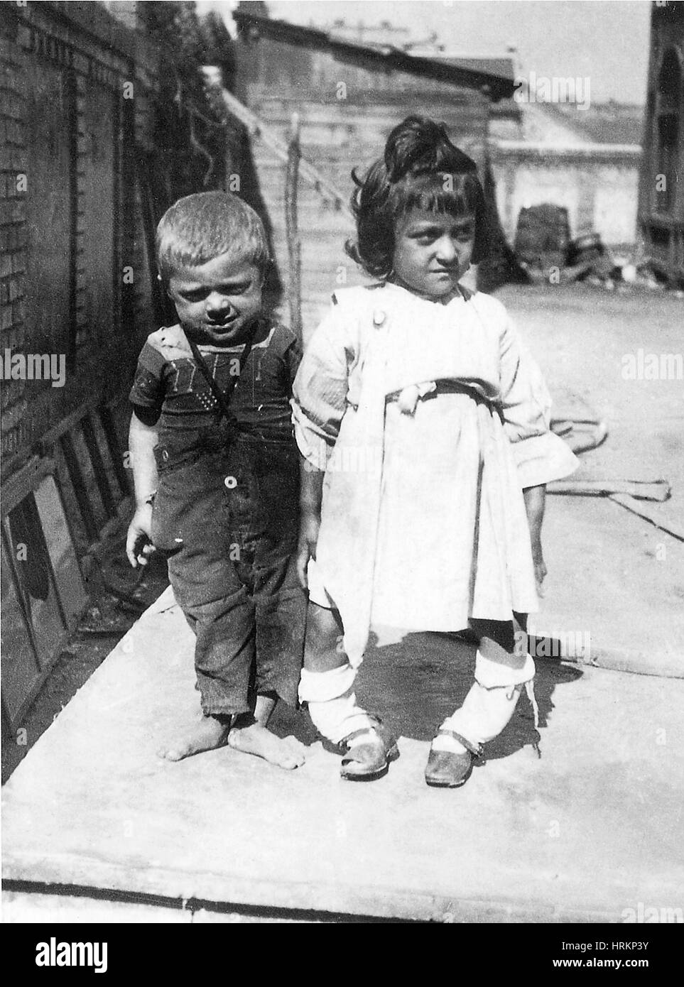 Childhood malnutrition -Fotos und -Bildmaterial in hoher Auflösung – Alamy