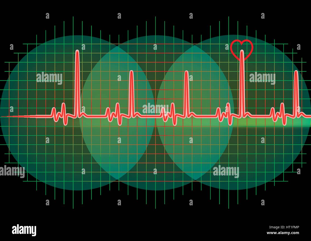 Ekg cardiogram monitor heartbeat -Fotos und -Bildmaterial in hoher ...
