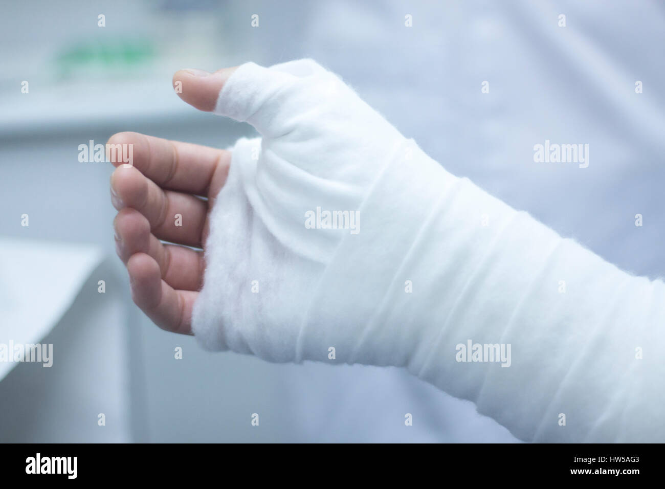 Arzt Patienten Unterarm und Handgelenk ein Gipsverband und Bandagen ...