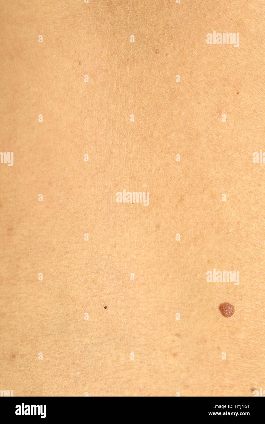 Human skin texture -Fotos und -Bildmaterial in hoher Auflösung – Alamy