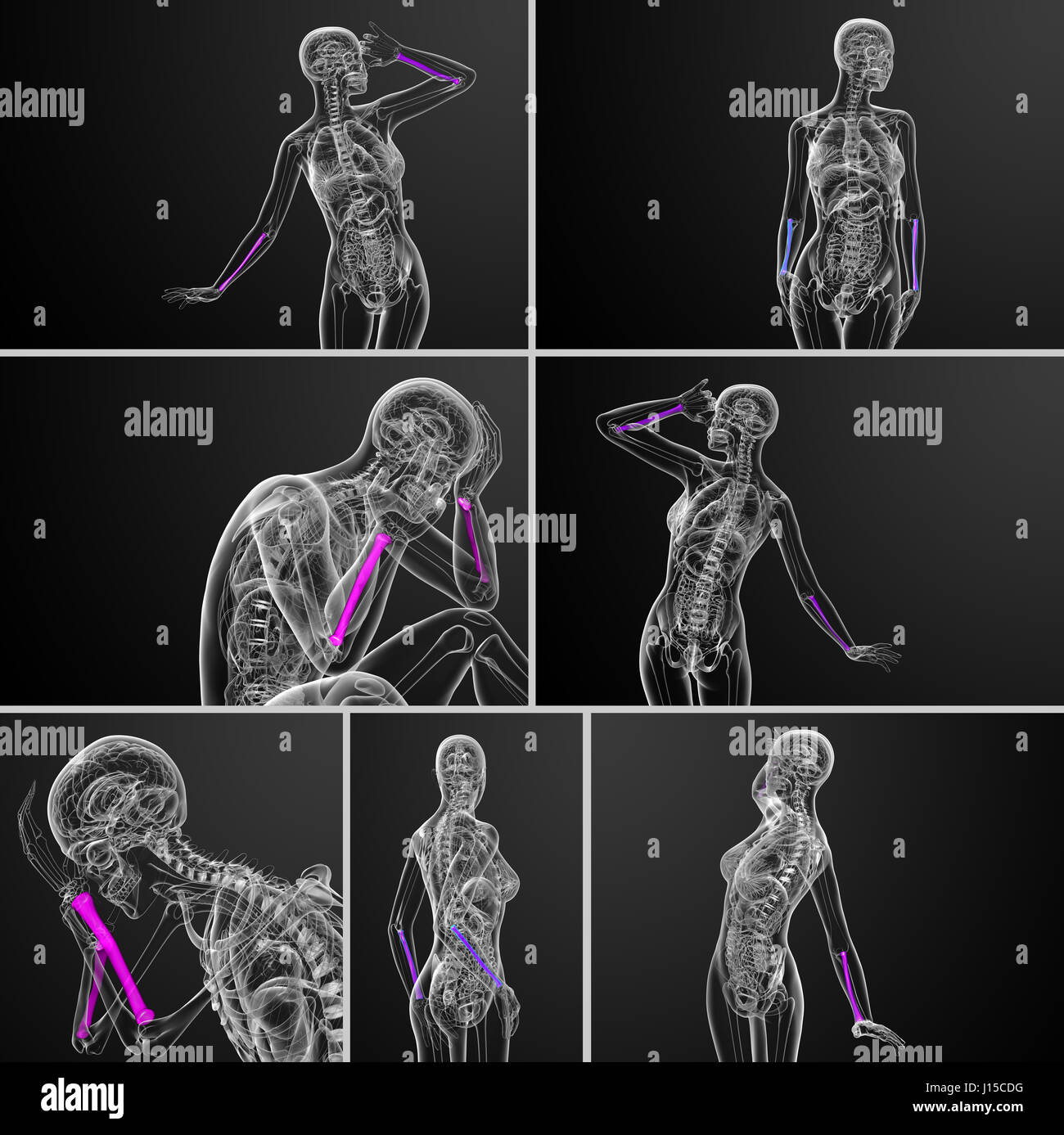 Das sind der radius und die ulna -Fotos und -Bildmaterial in hoher ...