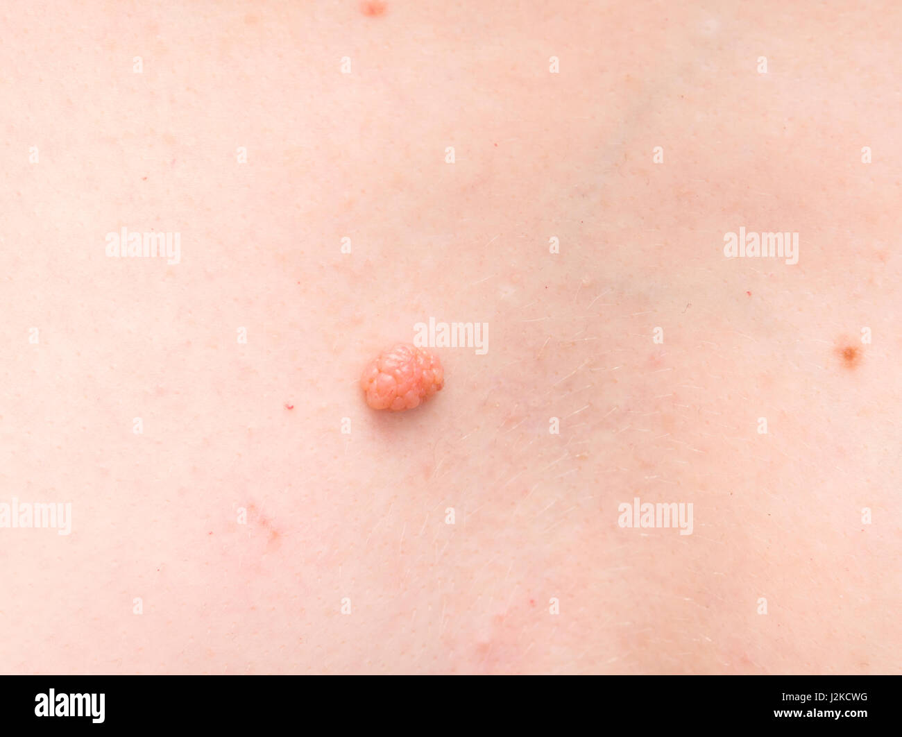 Erdbeer muttermal -Fotos und -Bildmaterial in hoher Auflösung – Alamy