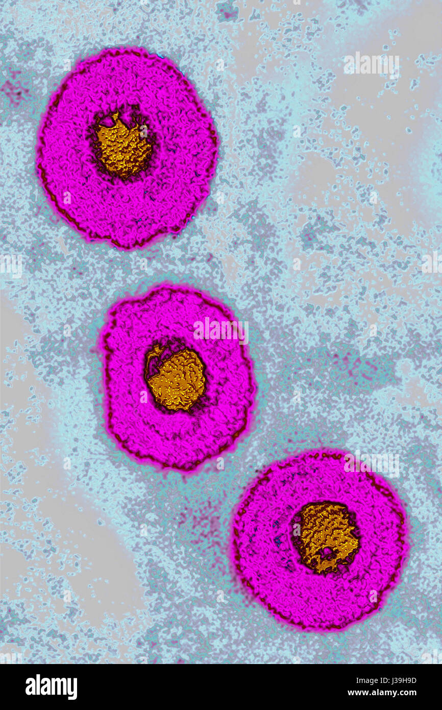 Menschliches herpesvirus 2 -Fotos und -Bildmaterial in hoher Auflösung – Alamy
