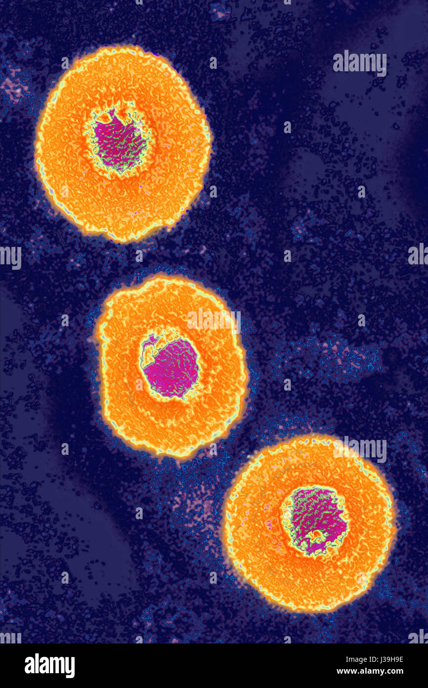 Menschliches herpesvirus 2 -Fotos und -Bildmaterial in hoher Auflösung ... Menschliches herpesvirus 2 -Fotos und -Bildmaterial in hoher Auflösung ...