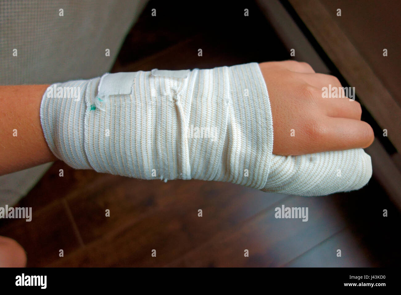 Broken arm with a cast on -Fotos und -Bildmaterial in hoher Auflösung ...