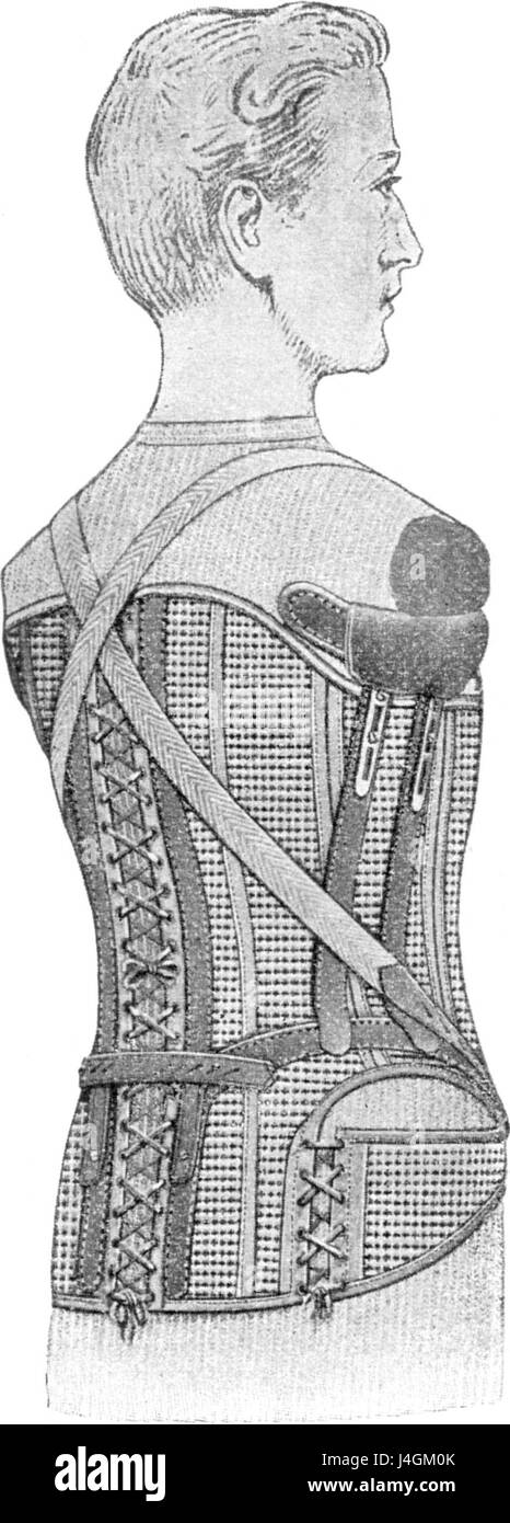 Skoliose korsett -Fotos und -Bildmaterial in hoher Auflösung – Alamy