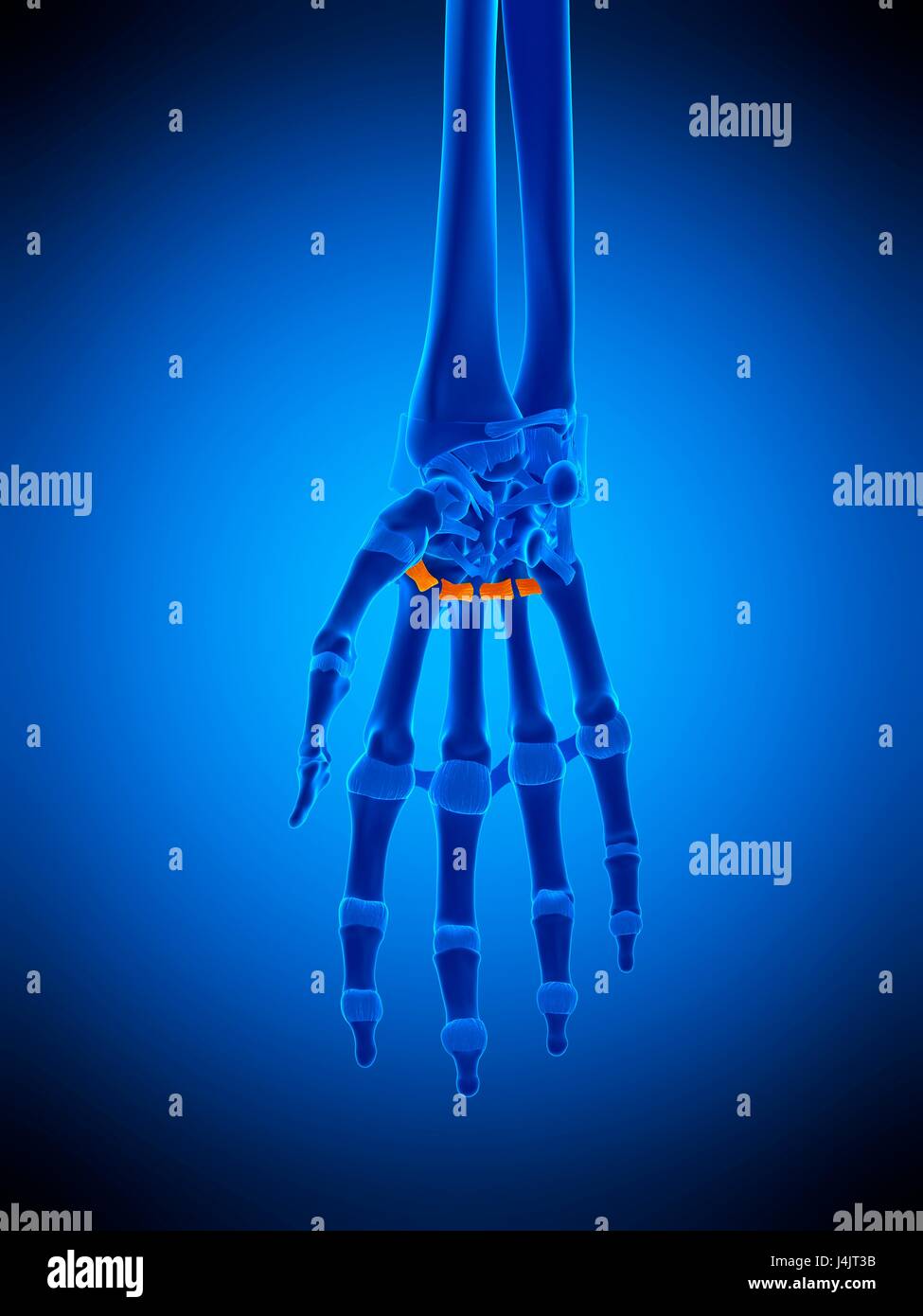 Illustration von palmar Mittelhandknochen Ligament Stockfotografie - Alamy