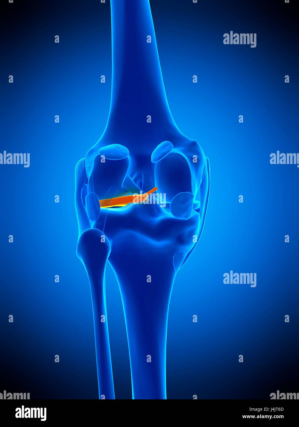 Seitlicher Meniskus Stockfotos und -bilder Kaufen - Alamy