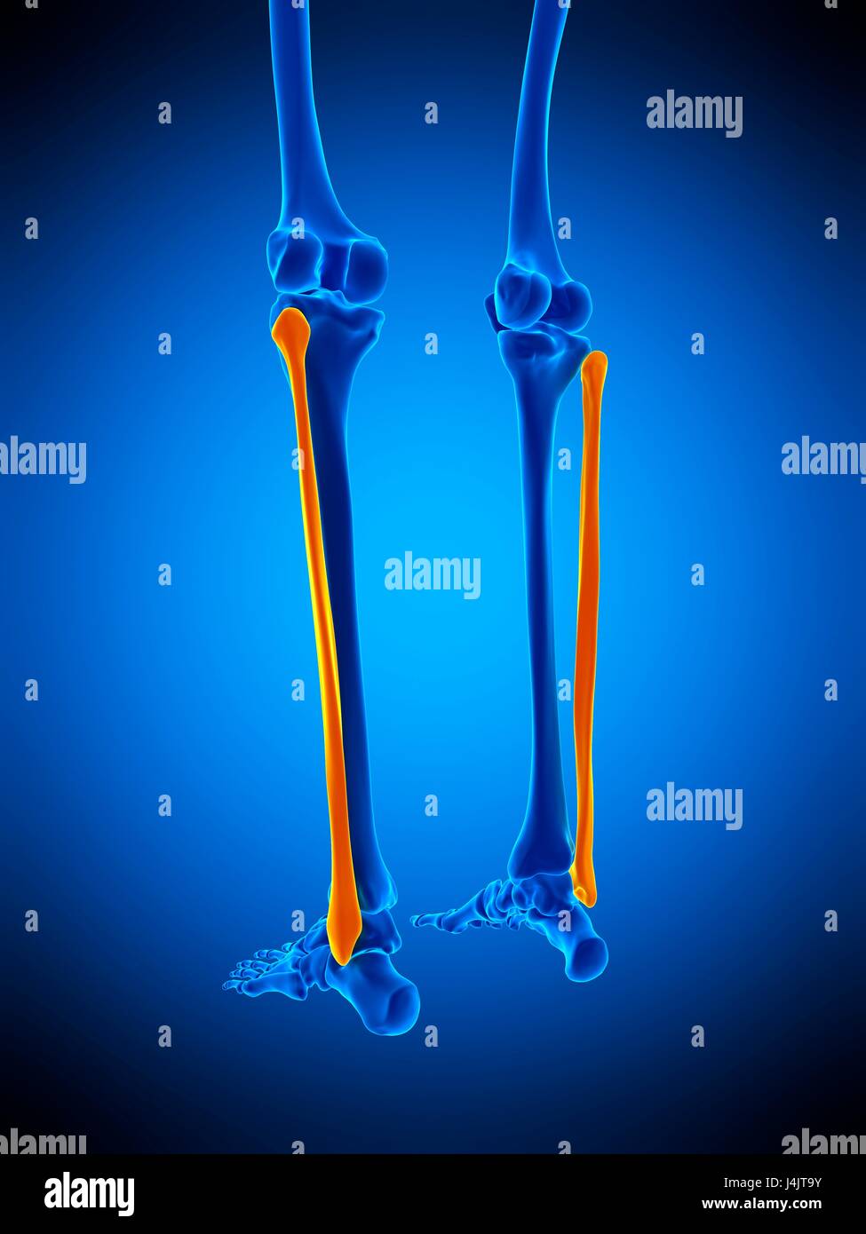 Illustration der Fibuladefekt Stockfotografie - Alamy