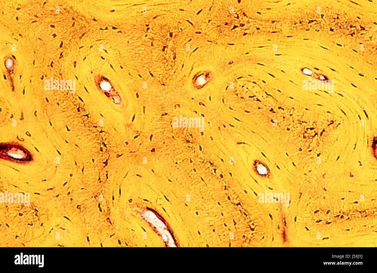 Knochen querschnitt -Fotos und -Bildmaterial in hoher Auflösung – Alamy