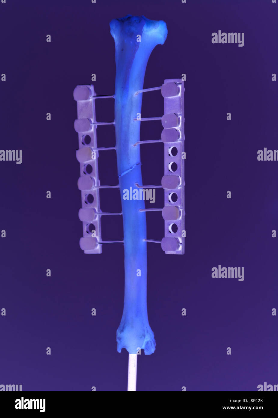 Knochenaufbau system -Fotos und -Bildmaterial in hoher Auflösung – Alamy