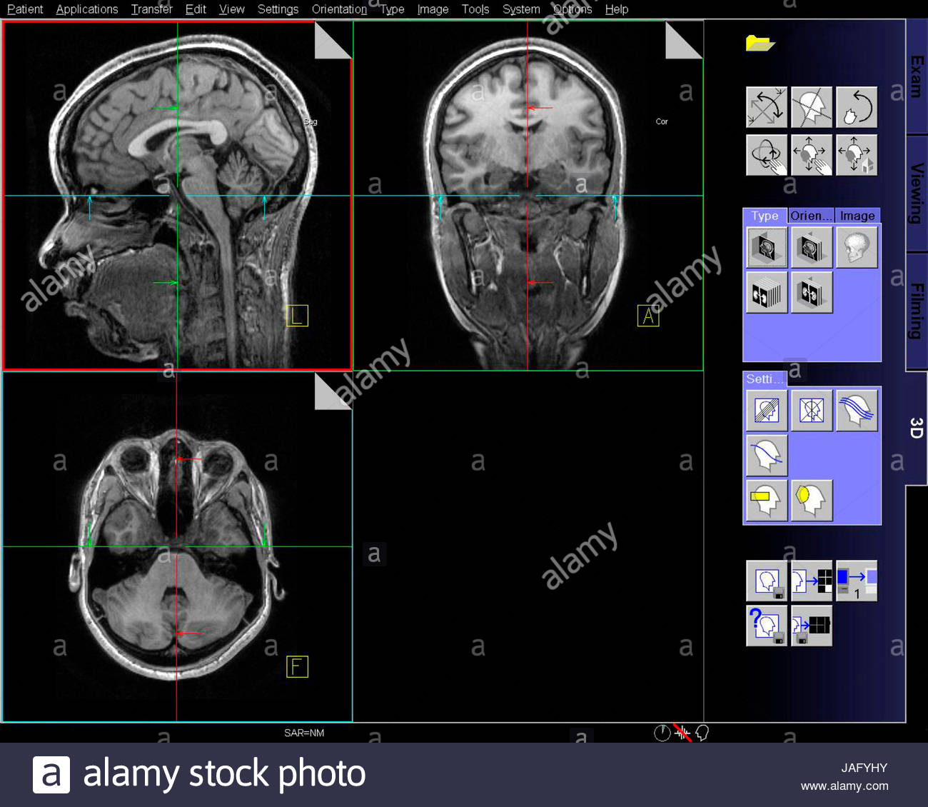 Axial Mri Stockfotos & Axial Mri Bilder - Alamy