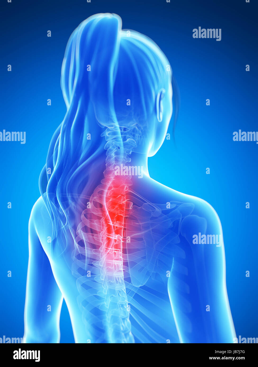 Cray x -Fotos und -Bildmaterial in hoher Auflösung – Alamy