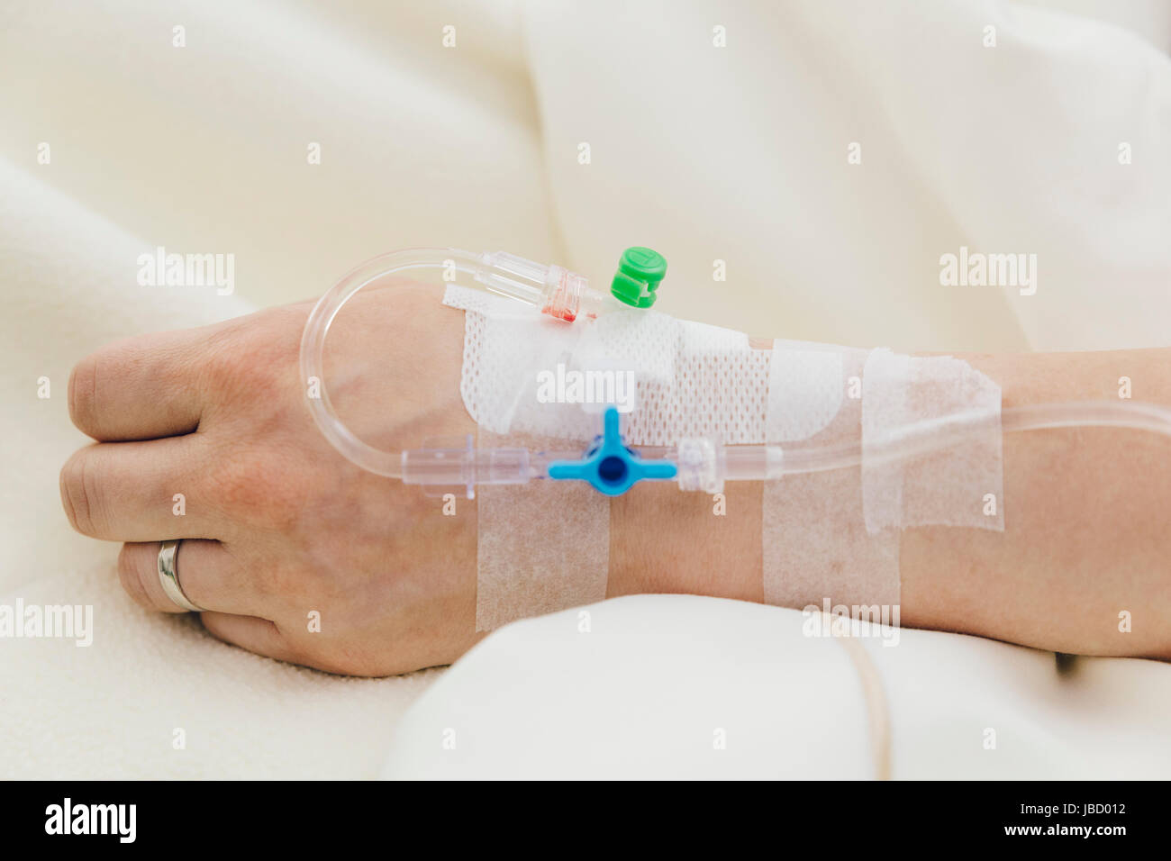Intravenous equipment -Fotos und -Bildmaterial in hoher Auflösung – Alamy