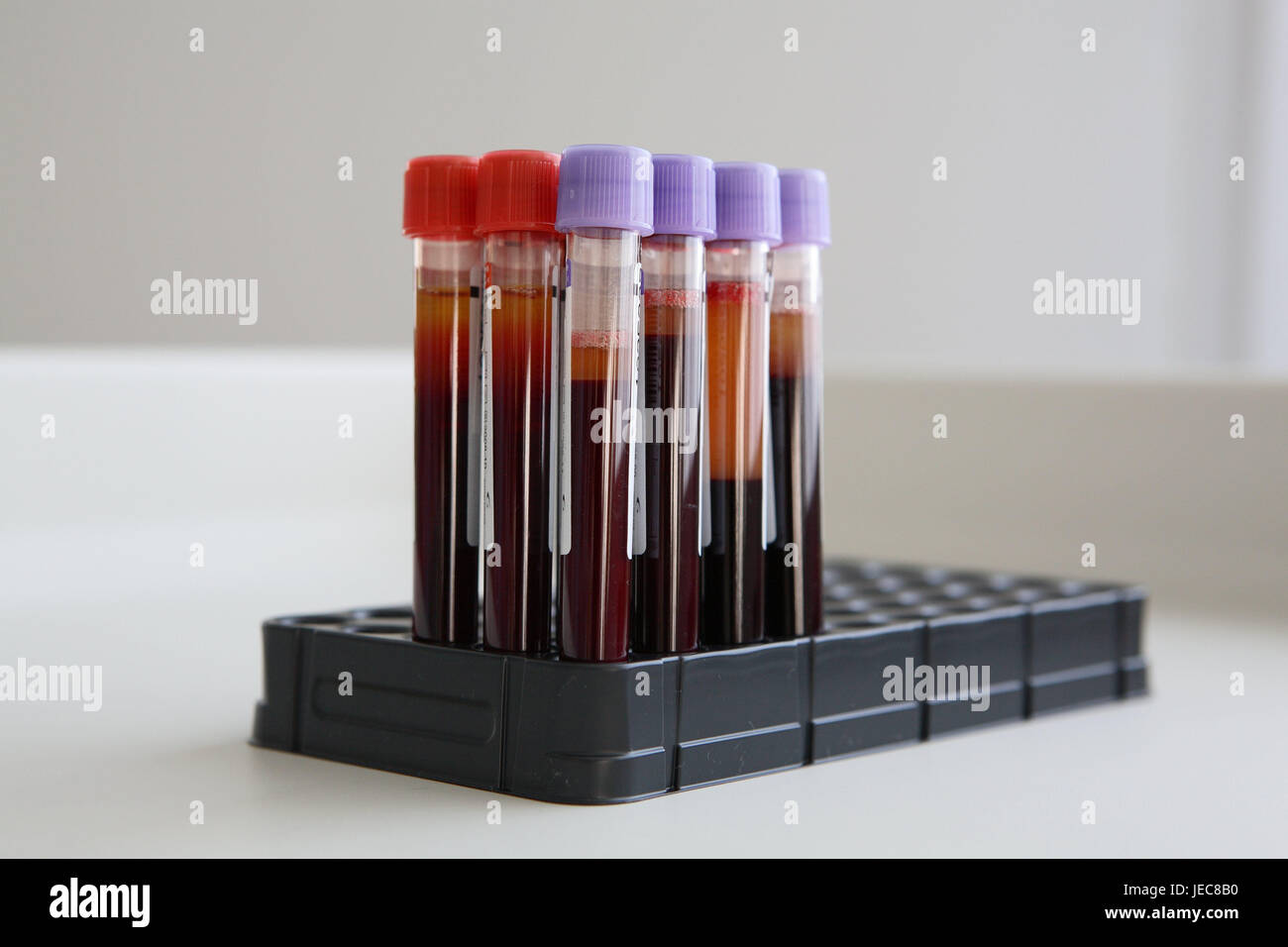 Labor, Probe Stand, Reagenzglas, Blut, Medizin, Krankenhaus, Blutbank ...