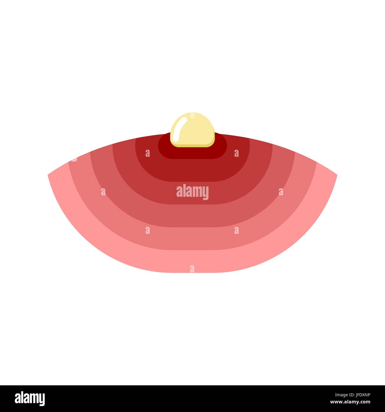 Akne, isoliert. Pickel mit Eiter auf weißem Hintergrund. Furunkel Stock ...