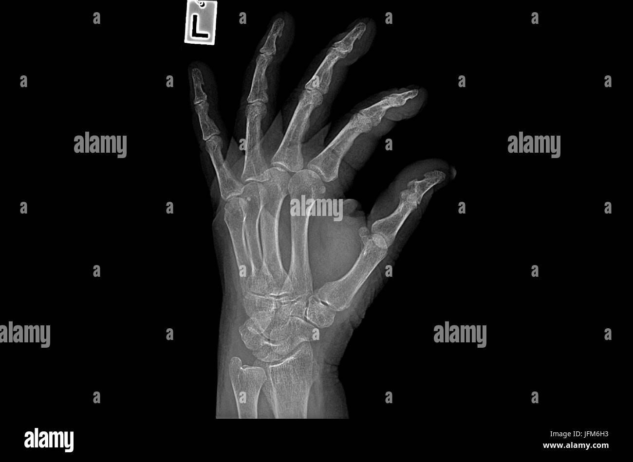 Hand anatomie röntgen -Fotos und -Bildmaterial in hoher Auflösung – Alamy