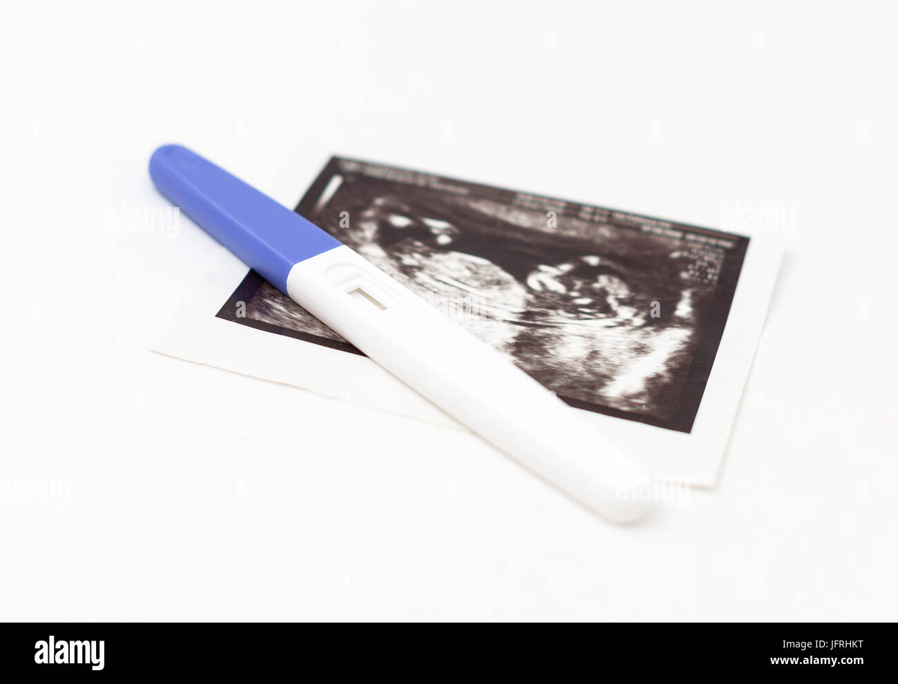 Ultra sonographie -Fotos und -Bildmaterial in hoher Auflösung – Alamy