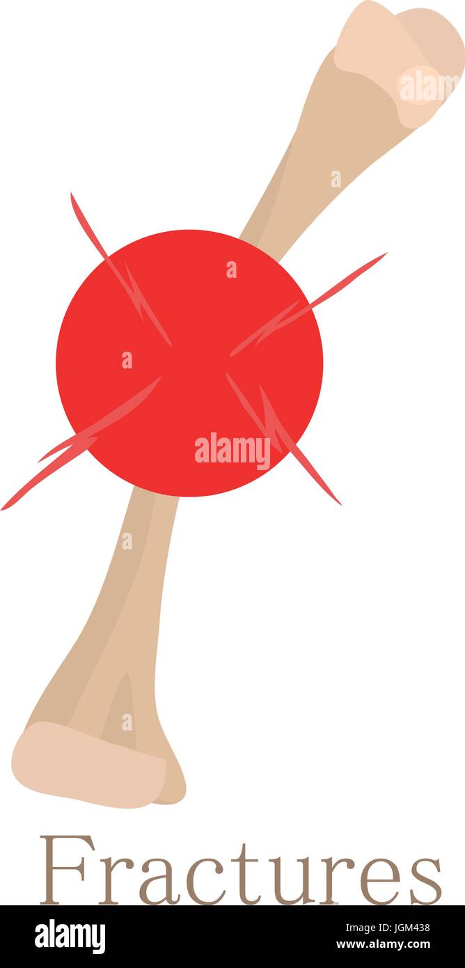 Unterarm knochen anatomie Stock-Vektorgrafiken kaufen - Alamy