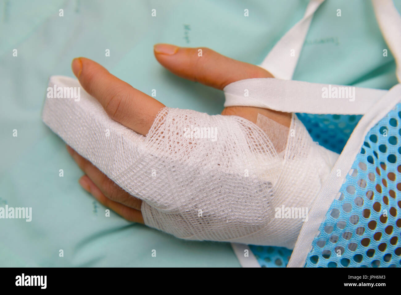 Gebrochener finger -Fotos und -Bildmaterial in hoher Auflösung – Alamy