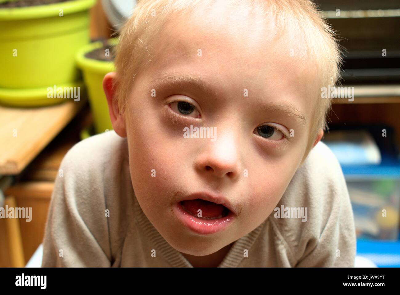 Down syndrom -Fotos und -Bildmaterial in hoher Auflösung – Alamy