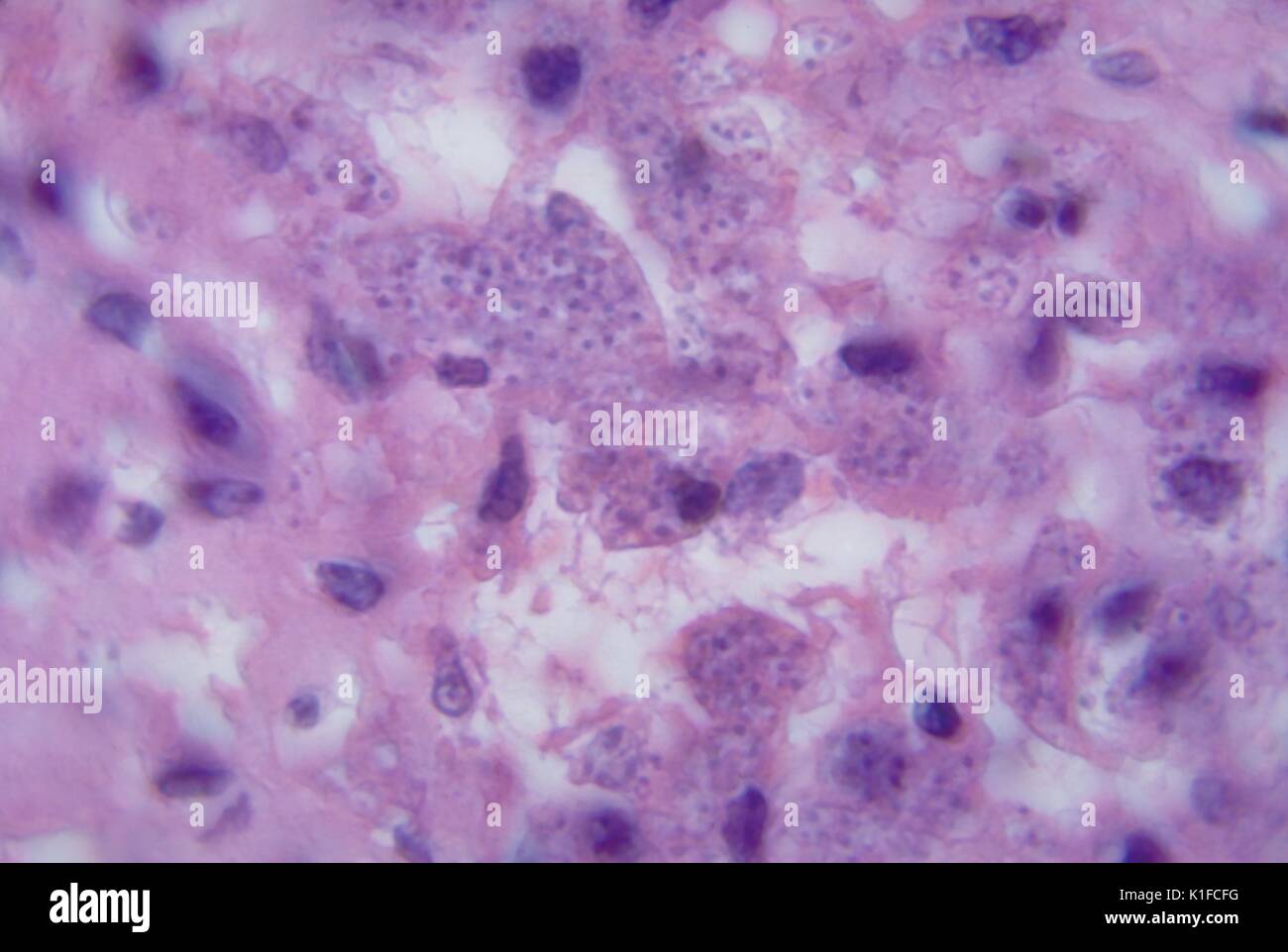 Histopathologie der Leishmaniose des subkutanen Gewebes durch ...