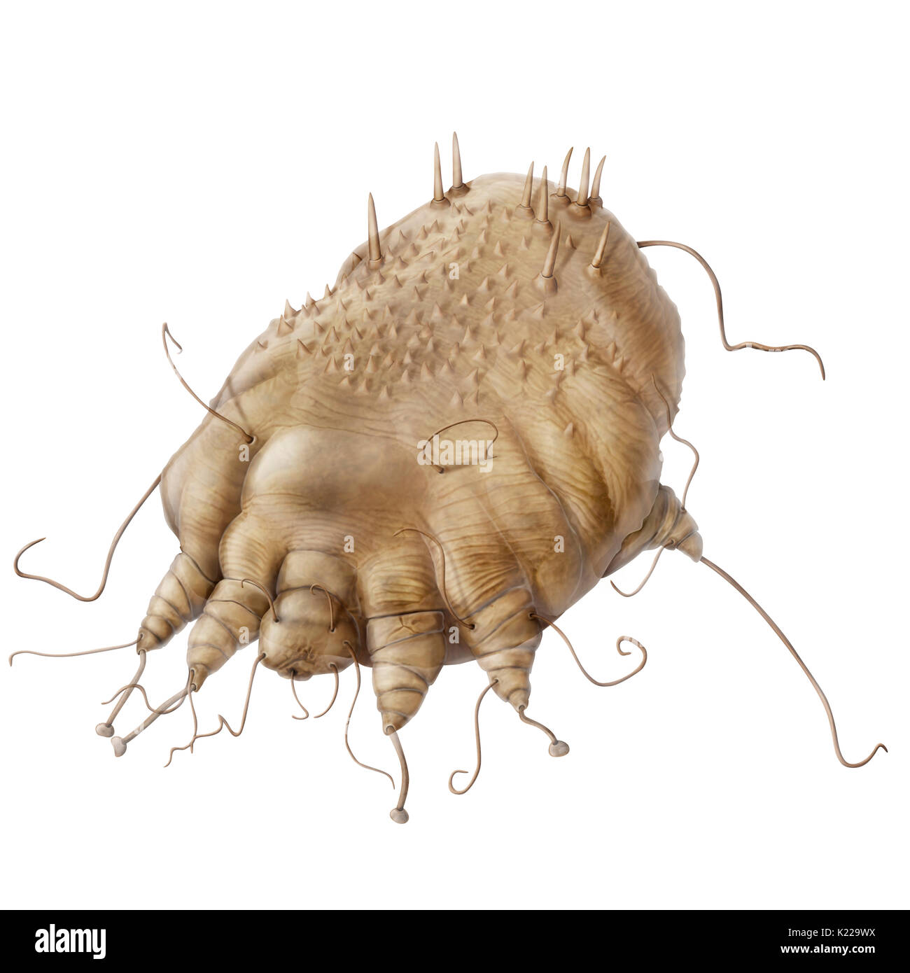 Scabies ist eine Hauterkrankung, die durch eine milbe Sarcoptes scabiei ...